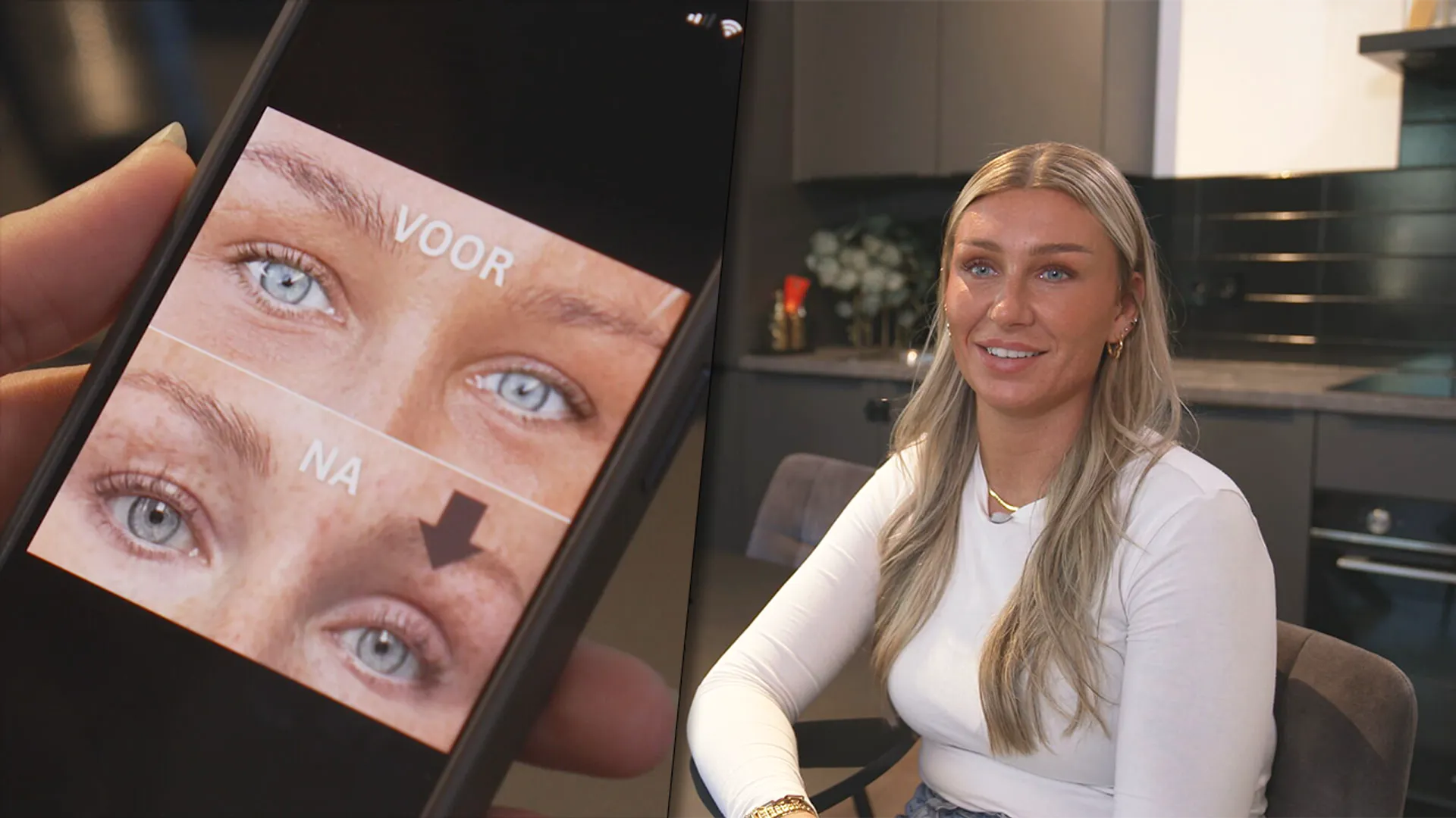 Gebruik van populaire wimperserums niet zonder risico: "Kan blijvende ...