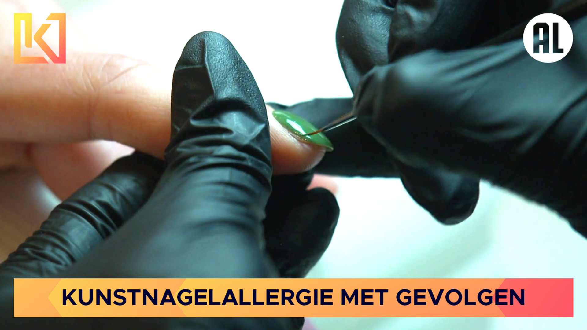 Allergie door gellak: hoe gevaarlijk zijn gelnagels? - Kassa - BNNVARA